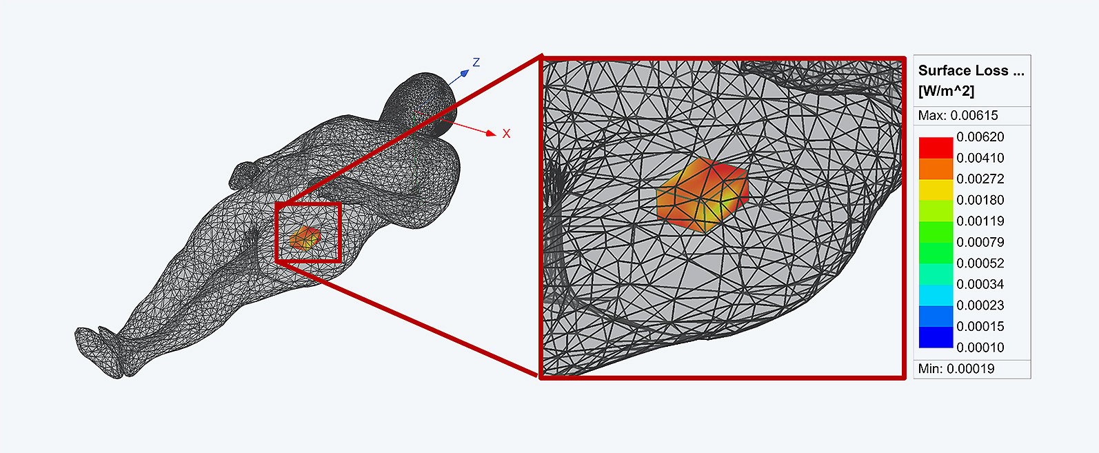 MRI despite implant? Simulation protects against heat damage